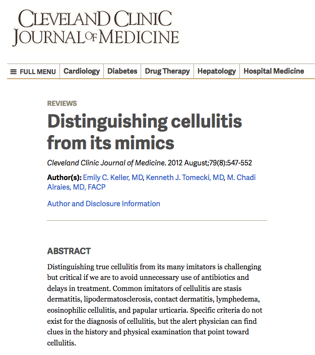 Stasis Dermatitis Library - Dermatitis Academy